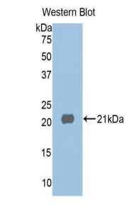 Histone Deacetylase 6 (Hdac6) Polyclonal Antibody | Scientist.com