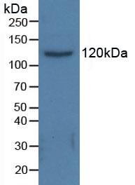 Histone Deacetylase 6 (Hdac6) Polyclonal Antibody | Scientist.com