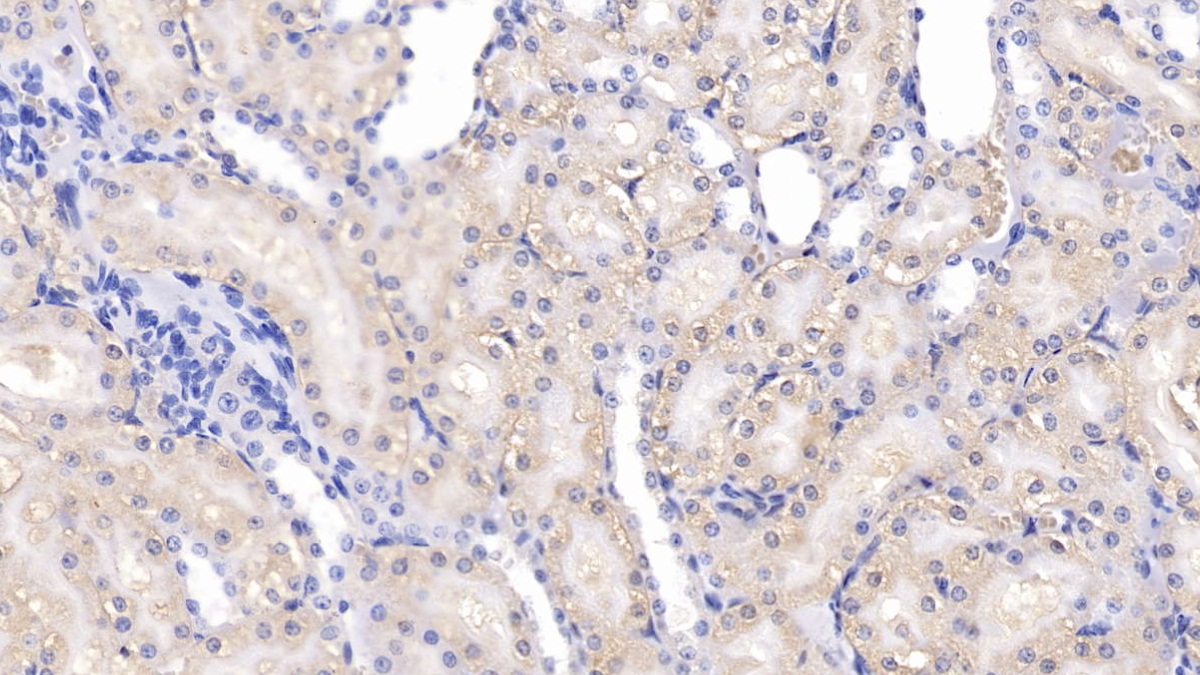 Histone Deacetylase 6 (Hdac6) Polyclonal Antibody | Scientist.com